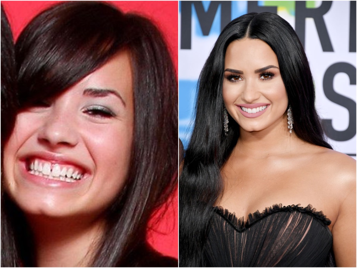 ≡ Hollywood's Pearly Whites Under the Spotlight 》 Her Beauty